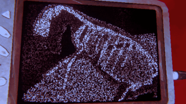 How to do the Ultrasound and Escape the Vents - Mouthwashing ...